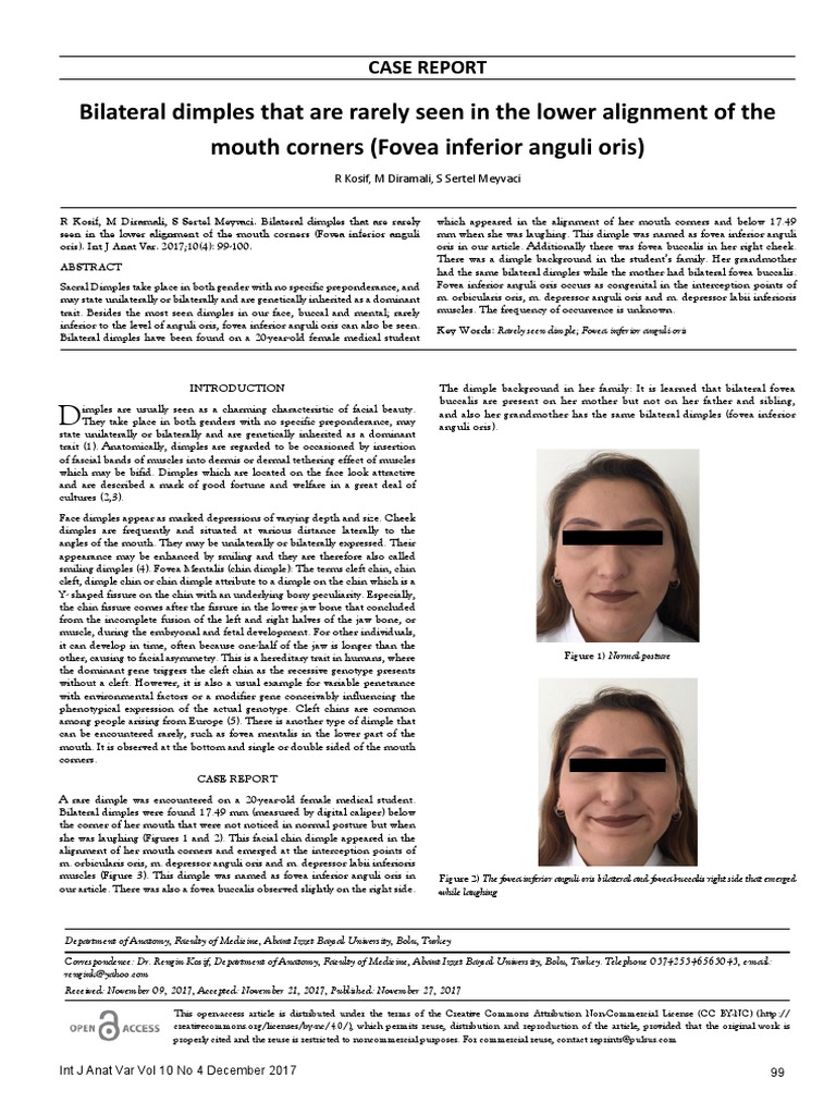 Bilateral Dimples That Are Rarely Seen in The Lower Alignment of The ...