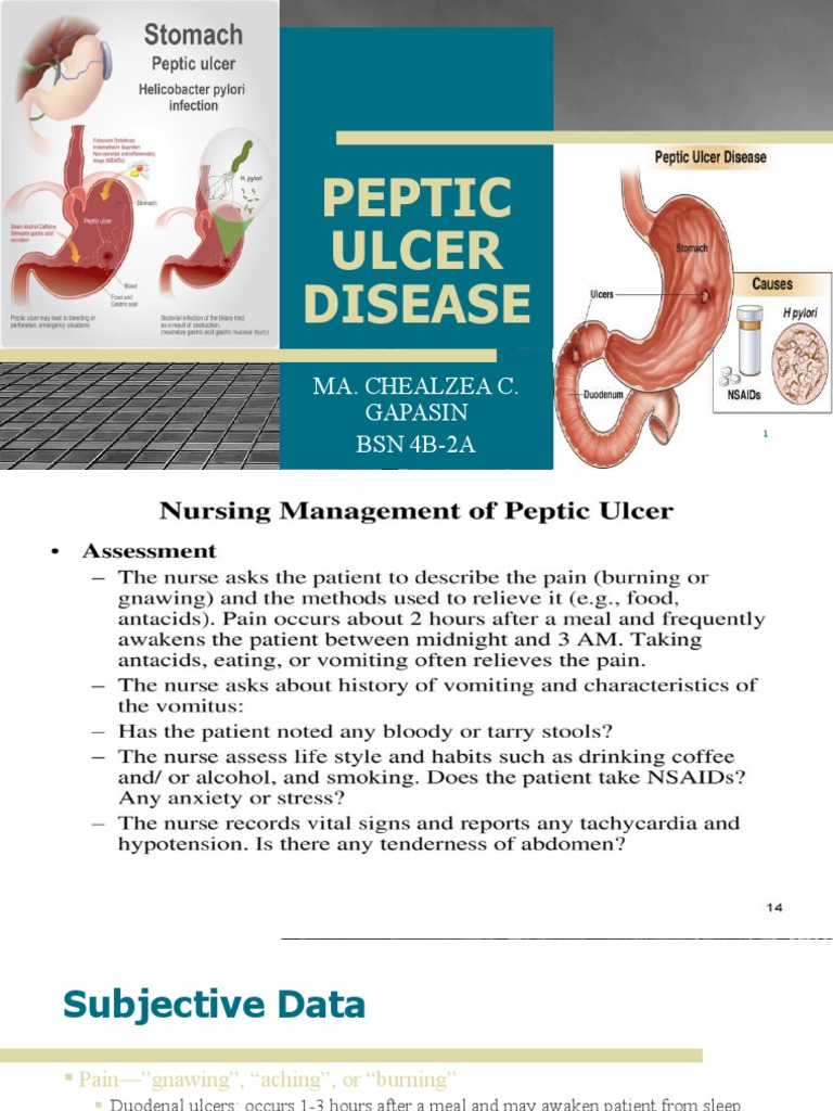 Peptic Ulcer Disease: Ma. Chealzea C. Gapasin BSN 4B-2A | PDF | Nausea ...