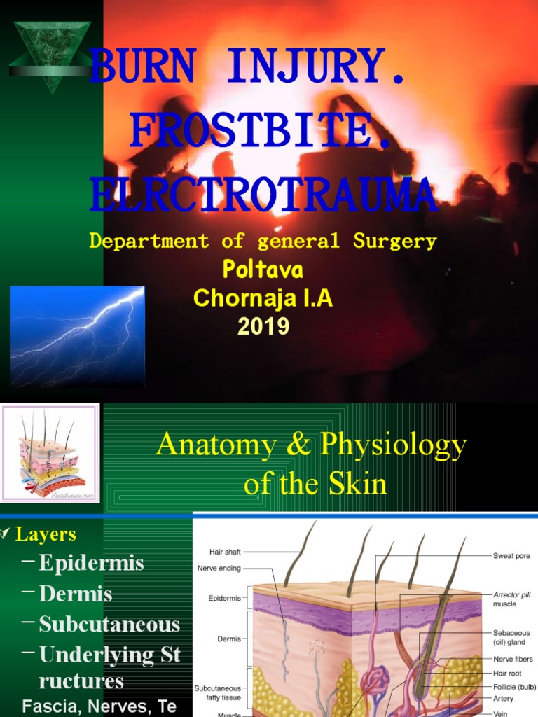 Burn Injury. Frostbite. Elrctrotrauma: Department of General Surgery ...