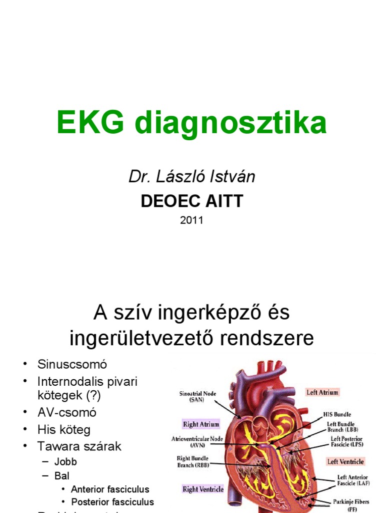 EKG Diagnosztika (Részletes) | PDF