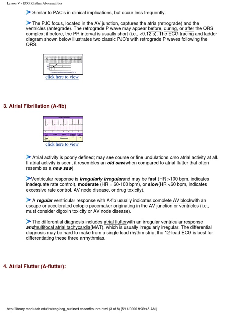 Click Here To View: 3. Atrial Fibrillation (A-Fib) | PDF