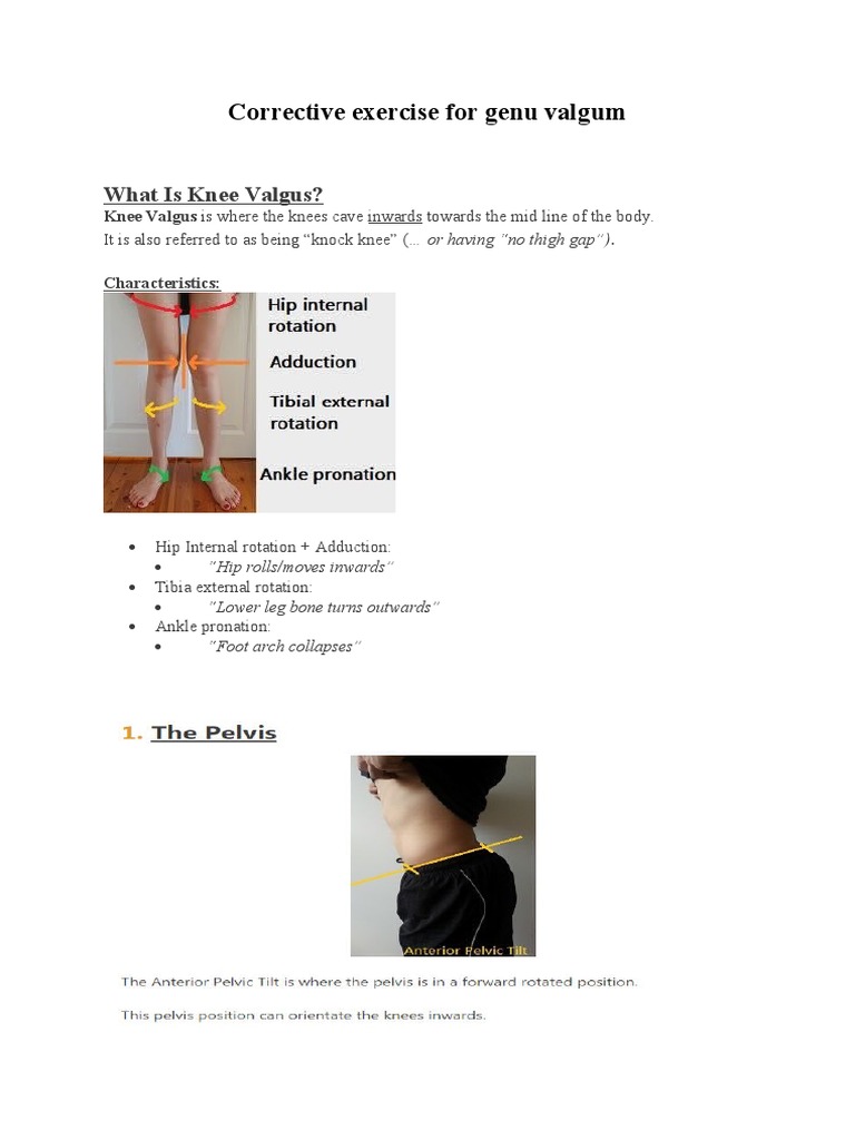 Corrective Exercises for Knee Valgus | PDF | Wellness
