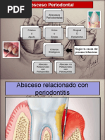 Absceso Apical: Agudo y Crónico | PDF | Inflamación | Especialidades ...