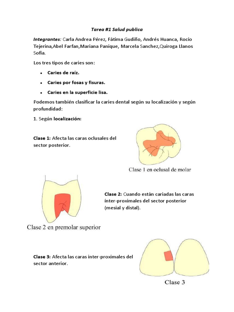 Tipos de Caries Dental | PDF