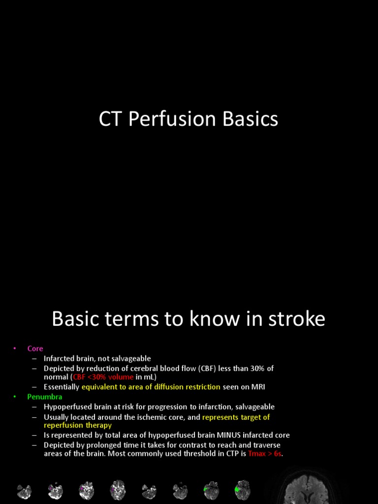 CT Perfusion PDF | PDF | Perfusion | Stroke