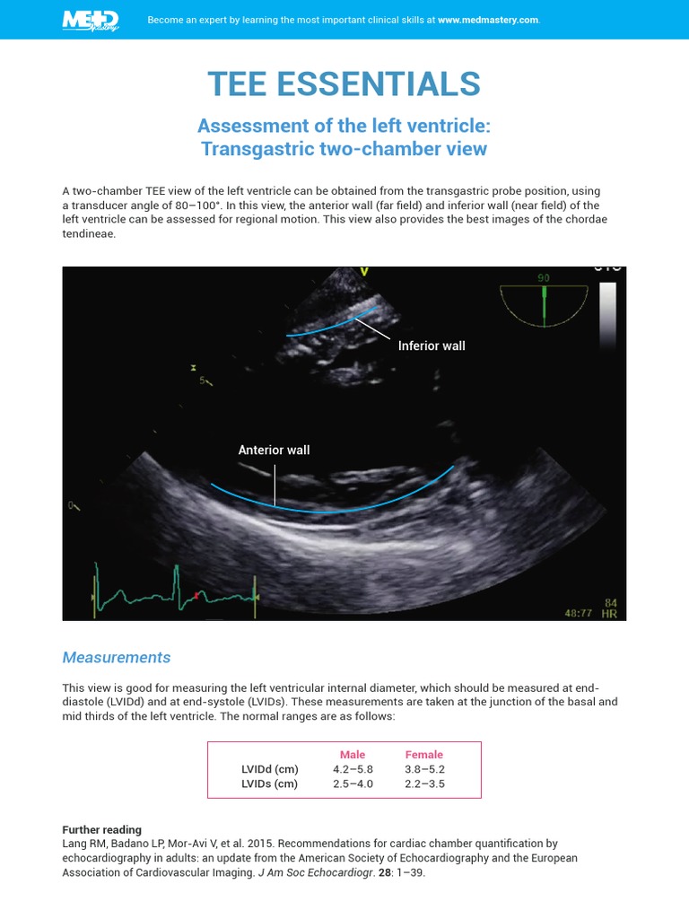 Fact Sheet 15 - Transgastric Two-Chamber View | PDF