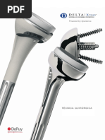 Guía de Osteosíntesis: Placas y Tornillos | PDF | Tornillo | Hueso