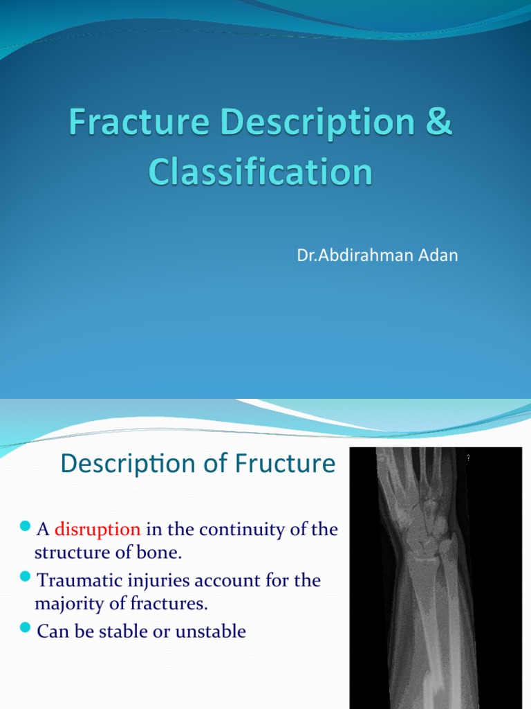 Lecture 2 Fractures Description & Classification | PDF ...