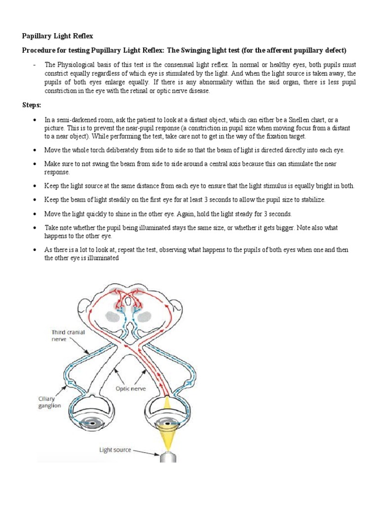 Papillary Light Reflex Procedure For Testing Pupillary Light Reflex ...