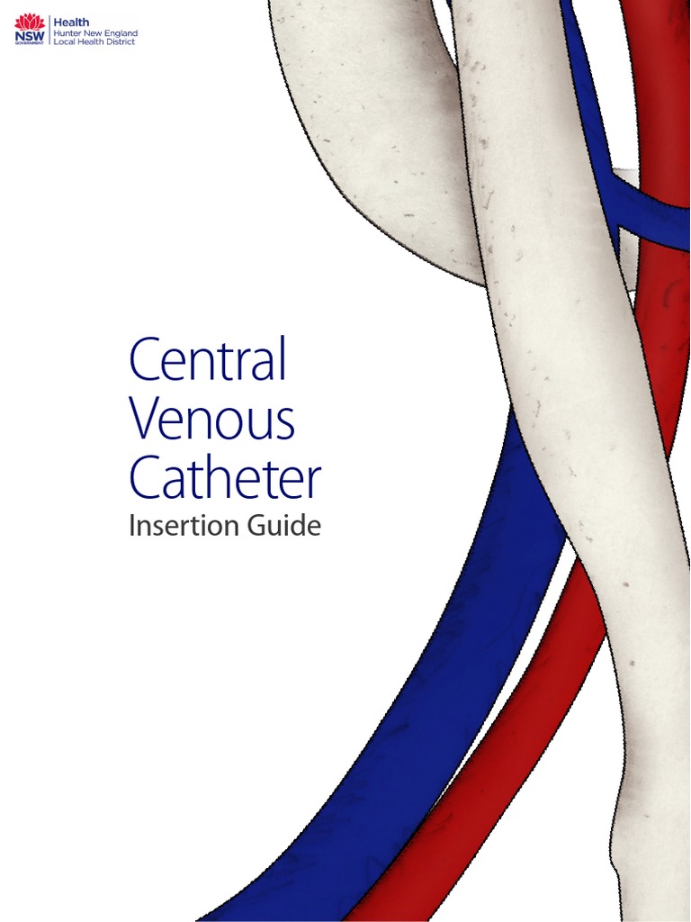 Central Venous Catheter: Insertion Guide | Download Free PDF | Medical ...