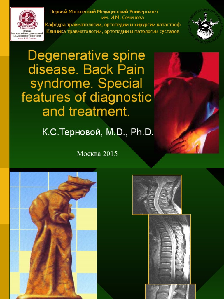 Гиперлордоз: диагностика и лечение | PDF | Back Pain | Clinical Medicine