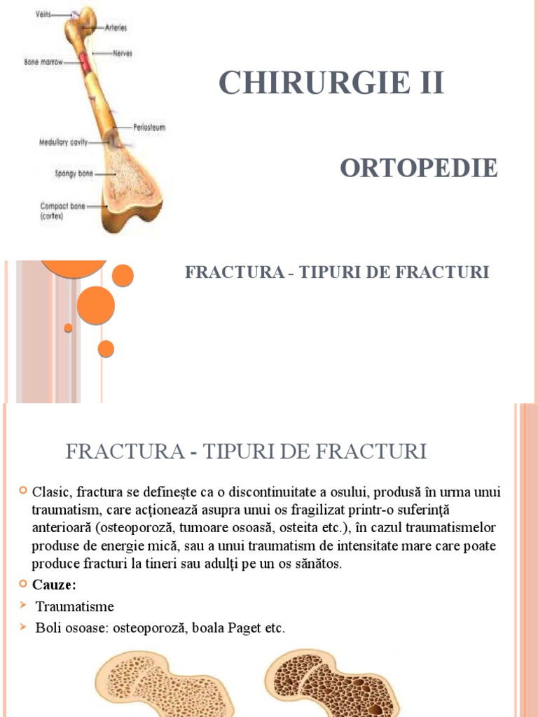 Tipuri de Fracturi | PDF