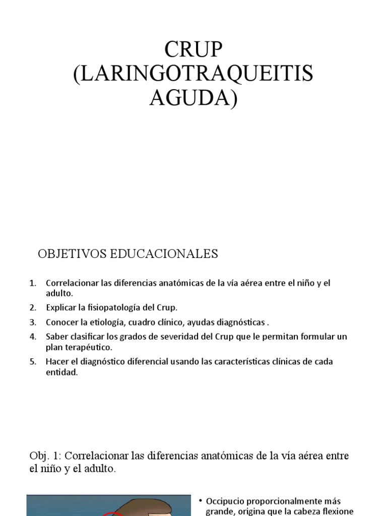 Crup: Laringotraqueitis Aguda en Niños | PDF | Enfermedades ...