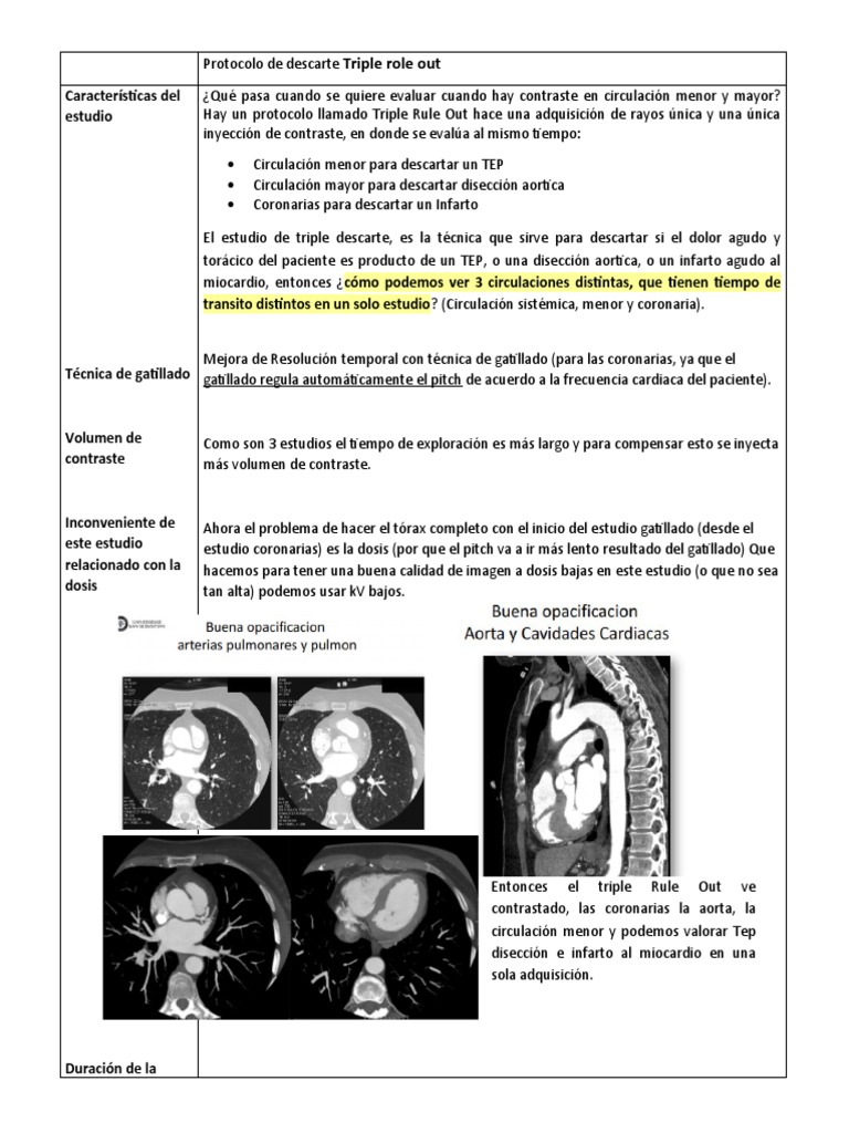 Triple Rule Out Scanner | PDF | Aorta | Infarto de miocardio