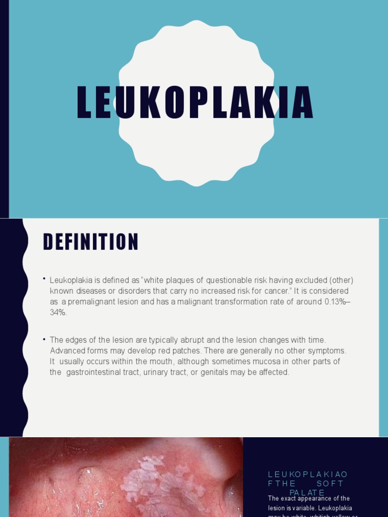 Leukoplakia 201119144109 | PDF | Anatomy | Biology