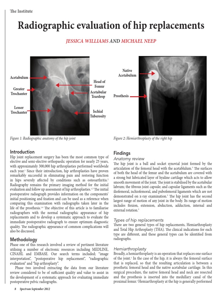 Hip Assess | PDF | Hip | Skeletal System