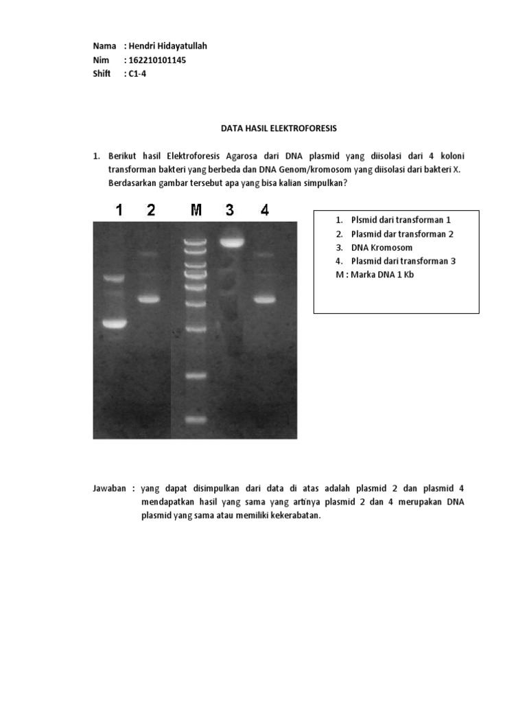 Analisis Elektroforesis DNA Plasmid | PDF