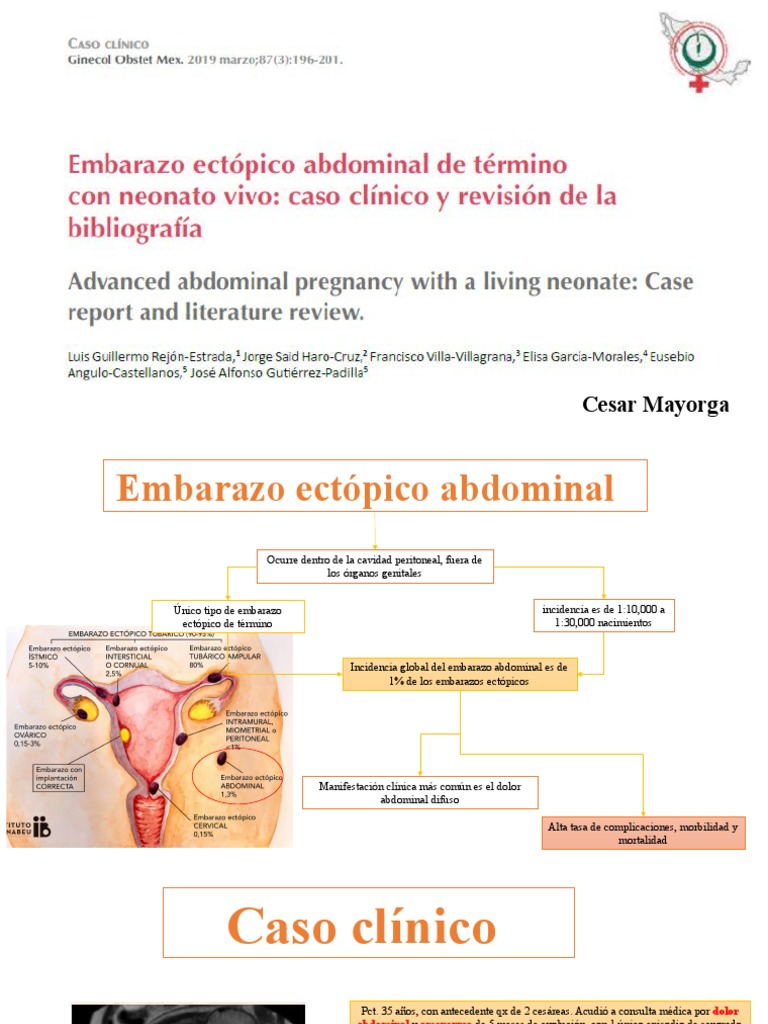 Embarazo Ectopico Abdominal | PDF | El embarazo | Placenta