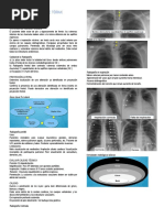 RX TORAX Como Se Lee | PDF | Tórax | Tórax (anatomía humana)
