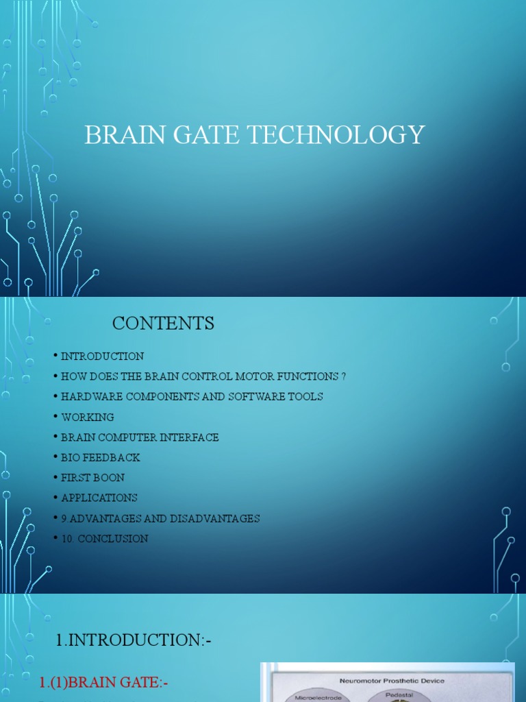 Brain Gate Technology | PDF | Brain | Electroencephalography