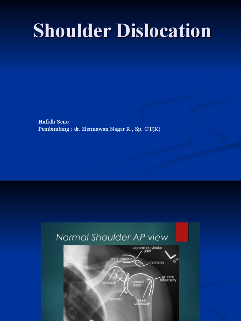 Shoulder Dislocation Guide | PDF | Shoulder | Musculoskeletal System