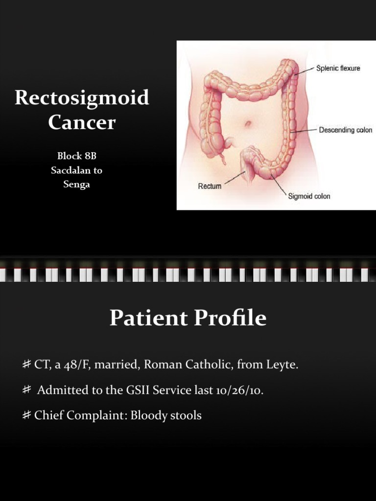 Rectosigmoid Cancer: A Case of Advanced Colorectal Adenocarcinoma in a 48-Year-Old Filipino ...