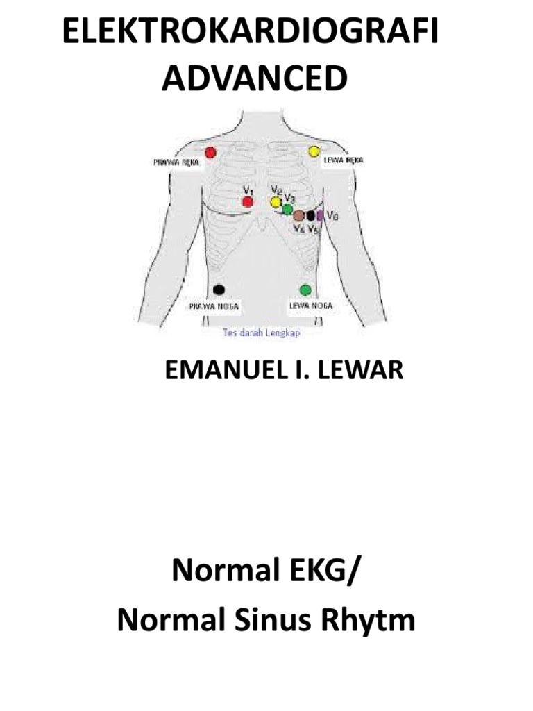 Ekg Advanced | PDF