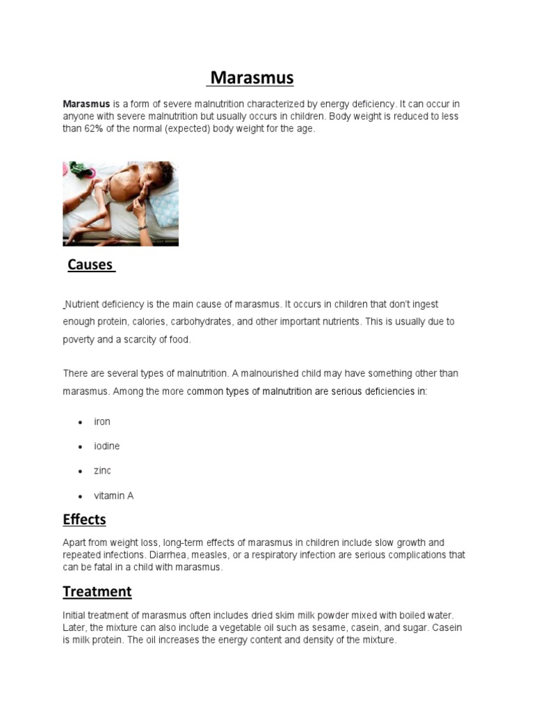 Marasmus | PDF