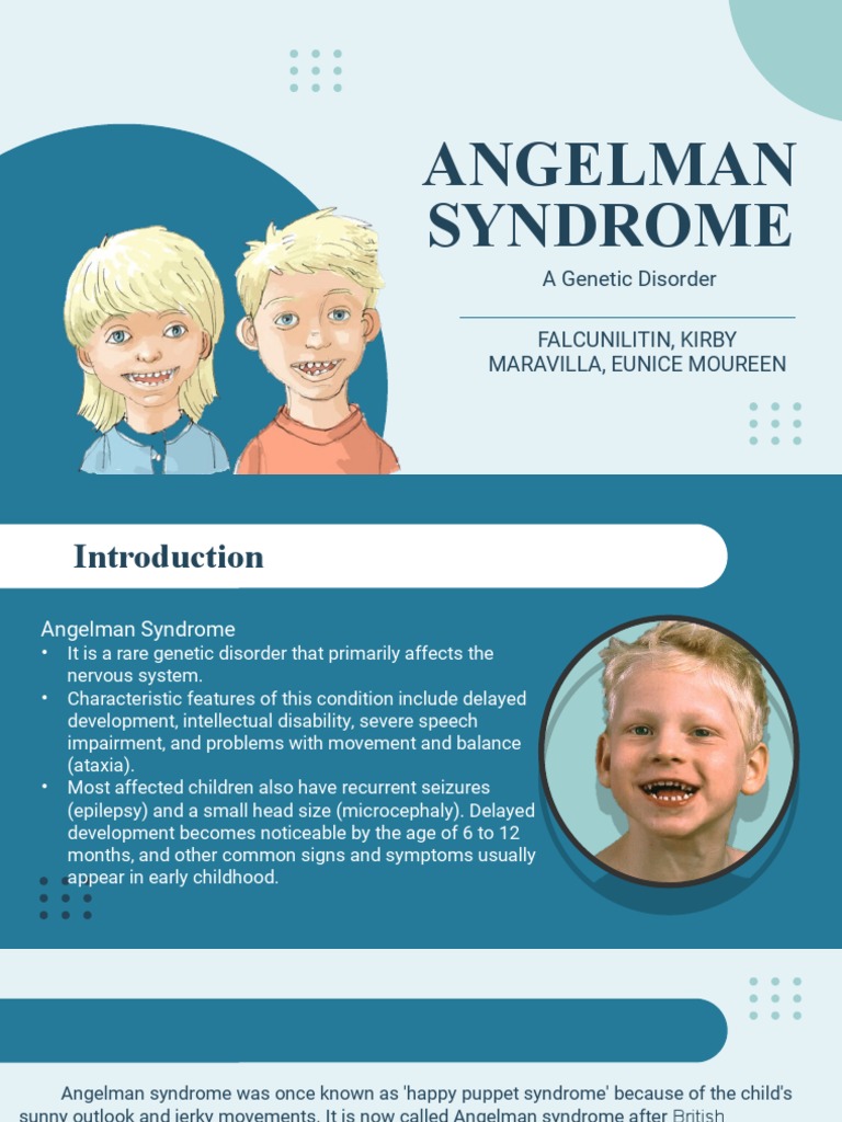 Angelman Syndrome Signs