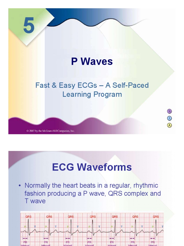 Interpreting P Waves: An In-Depth Look at Atrial Waveforms | PDF ...