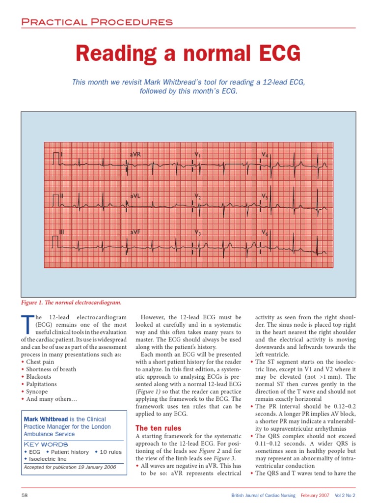 ECG pdf | Electrocardiography | Electrophysiology