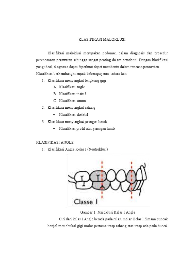 Klasifikasi Maloklusi (LI 3 Pertemuan 2) | PDF