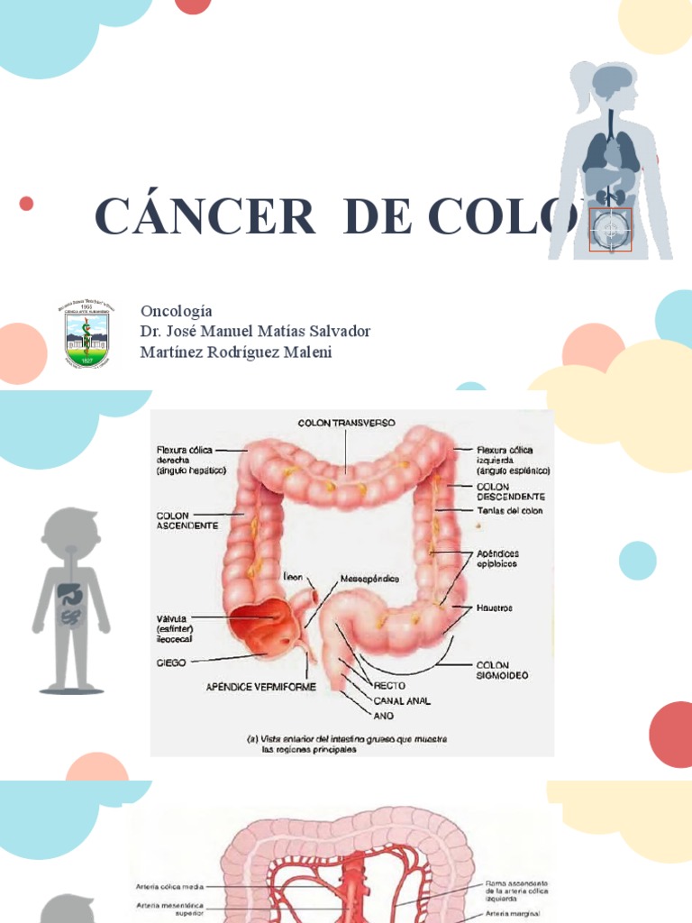 Cancer de Colon - 16. Martinez Rodriguez Maleni | PDF | Cáncer ...