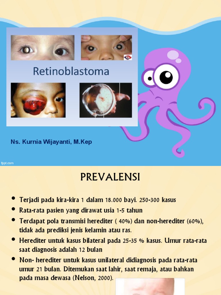 Retinoblastoma | PDF