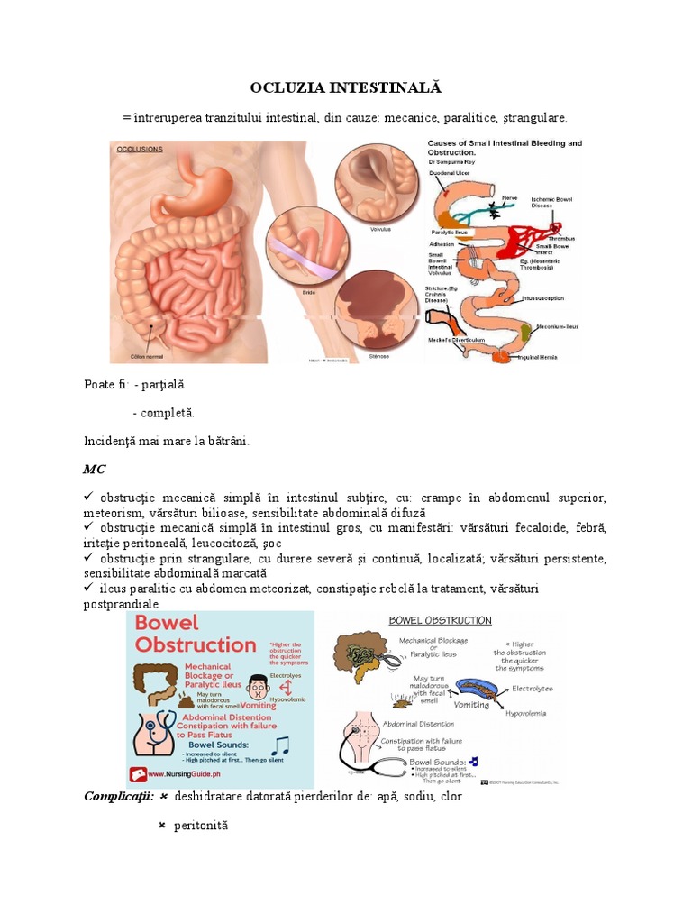 Ocluzia Intestinala RCT | PDF