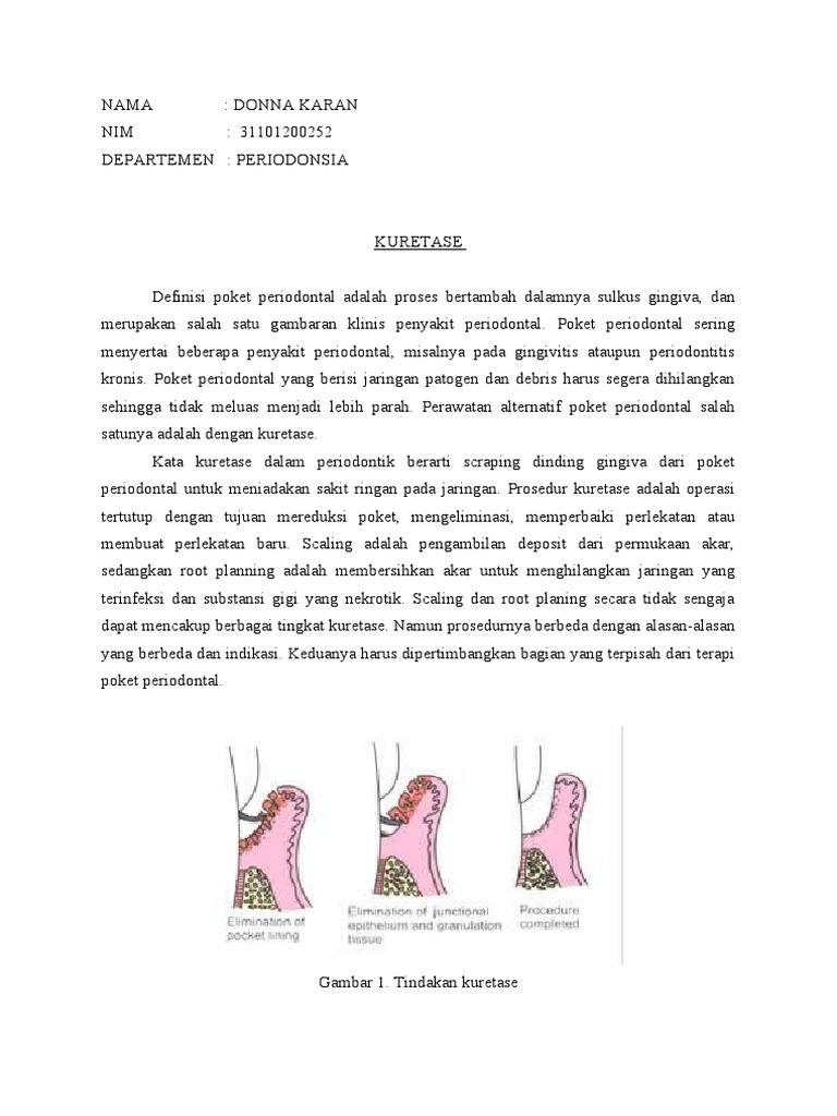 Kuretase Donna | PDF | Kesehatan Holistik