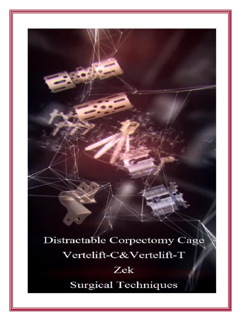 Surgical Techniques for Distractable Corpectomy Cages: An In-Depth ...