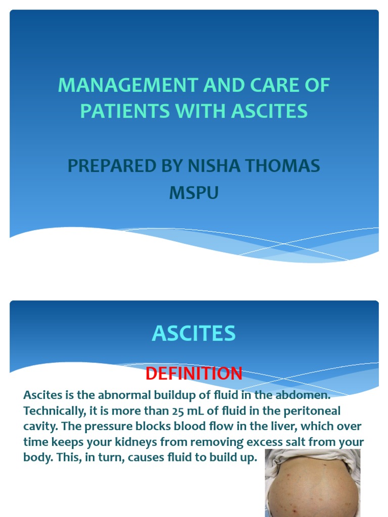 Management and Care of Patients With Ascites: Prepared by Nisha Thomas ...