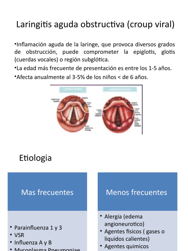 Laringitis Aguda Obstructiva (Croup Viral) | PDF | Rtt | Enfermedades y ...