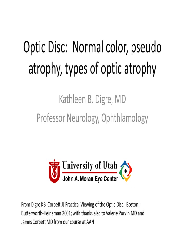 Optic Disc: Normal Color, Pseudo Atrophy, Types of Optic Atrophy | PDF ...