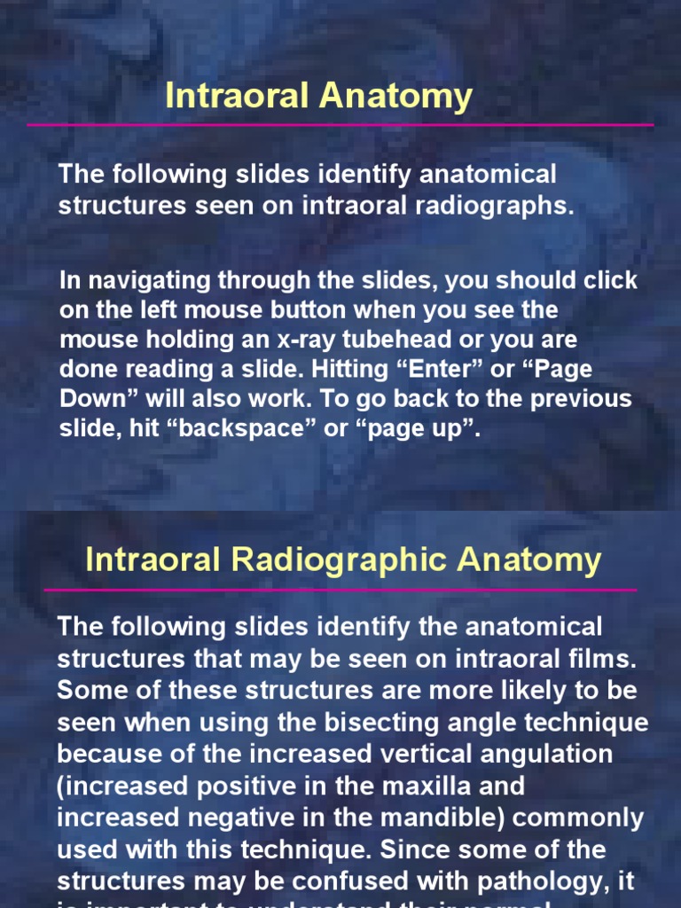 Intraoral Anatomy: The Following Slides Identify Anatomical Structures ...