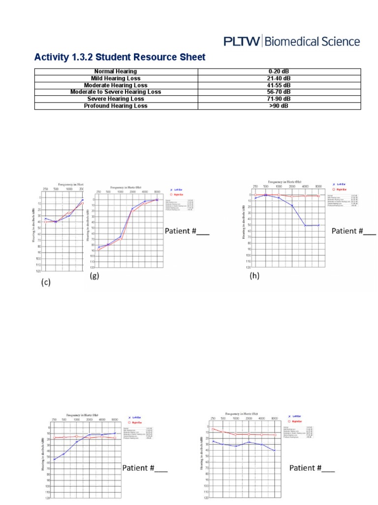 Hearing Loss Classification Guide | PDF | Science & Mathematics