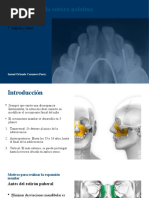Tipos de Expansores en Ortodoncia | PDF | Ortodoncia | Ramas de Odontología