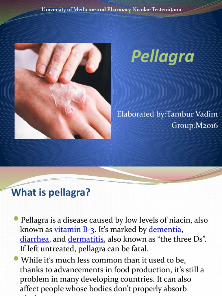 Pellagra: Elaborated By:tambur Vadim Group:M2016 | PDF | Rtt | Health ...