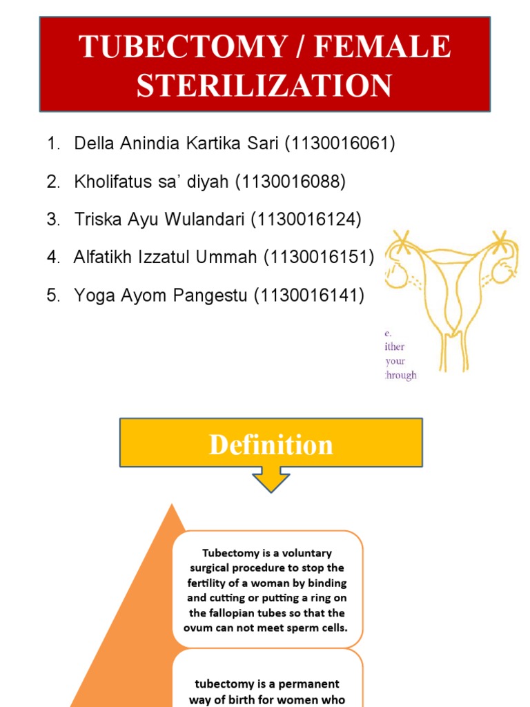 TUBECTOMY | PDF | Sexual Health | Women's Health