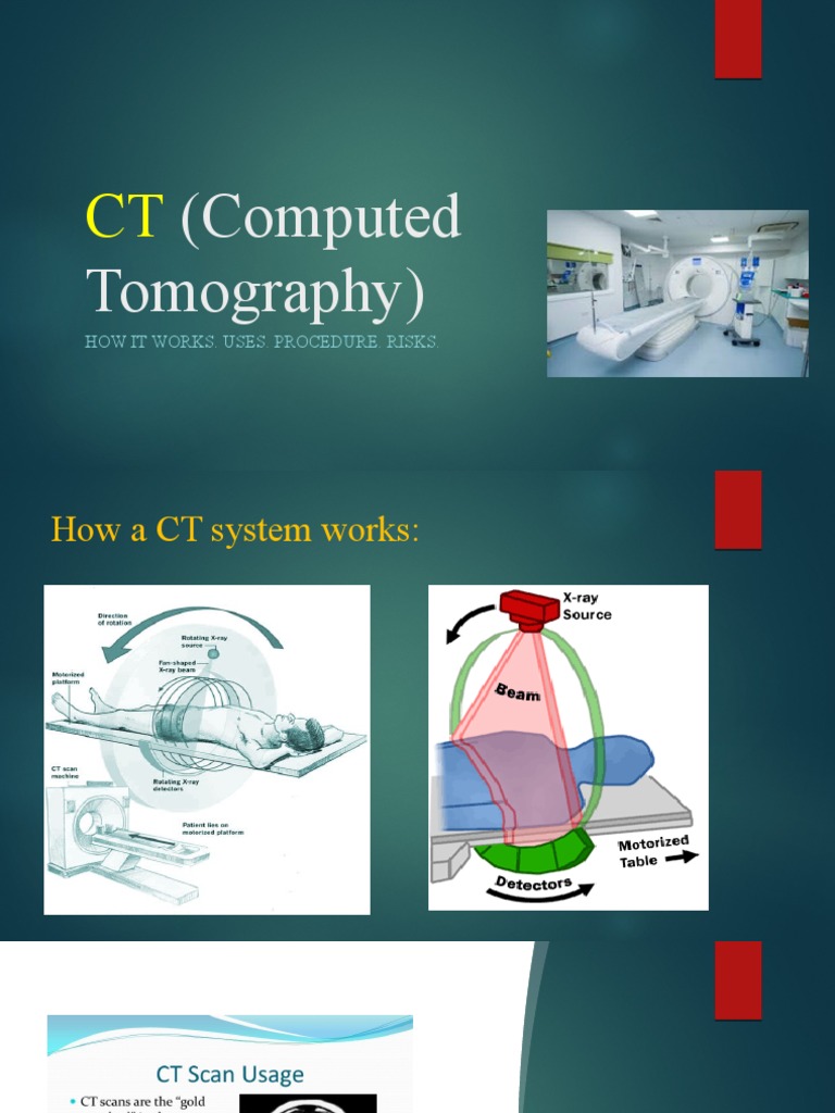 CT Scan: Procedure, Uses, and Risks | PDF | Young Adult