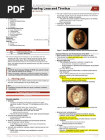 Stenger Test Guide | PDF | Hearing Loss | Ear