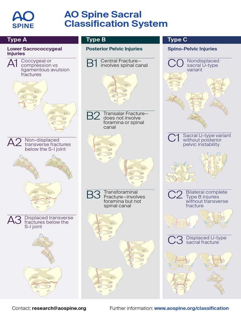 Coccygeal or Compression Vs Ligamentous Avulsion Fractures: Type A Type ...