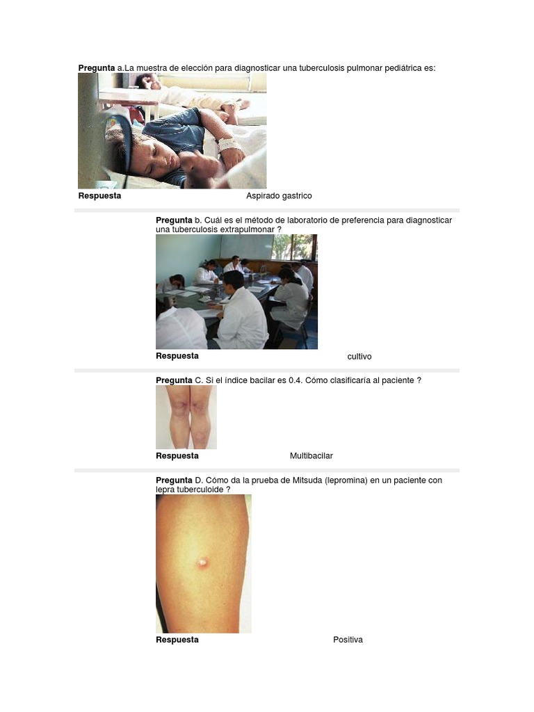 Prueba de Mitsuda en Lepra Tuberculoide | PDF | Especialidades Medicas ...