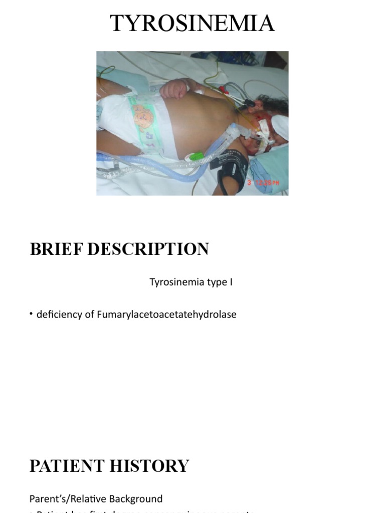 TYROSINEMIA | PDF | Medical Specialties | Clinical Medicine
